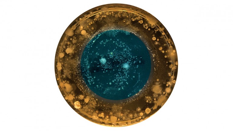 Portraits of Belly Button Bacteria – microBEnet: the microbiology of ...