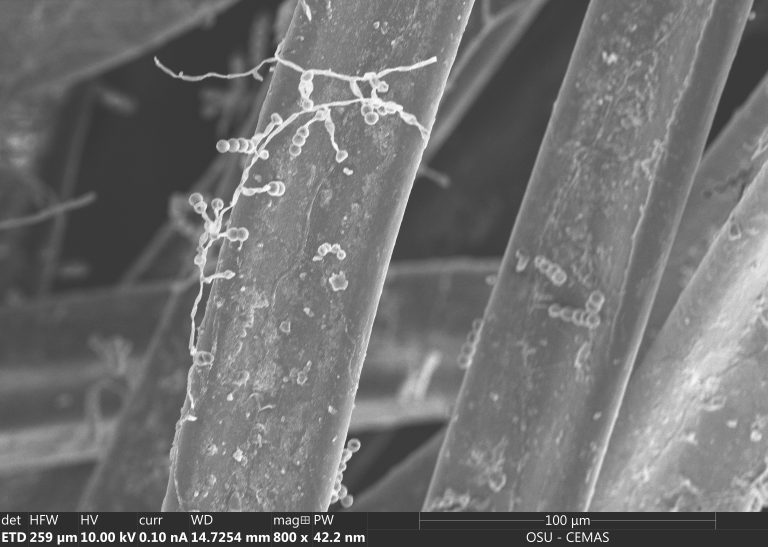 What factors influence microbial growth in carpet dust? – microBEnet ...